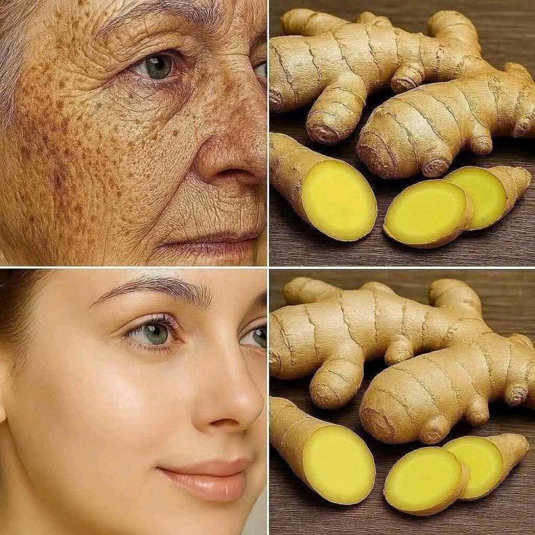 Ginger: A Natural Alternative to Botox for Healthy, Glowing Skin ...