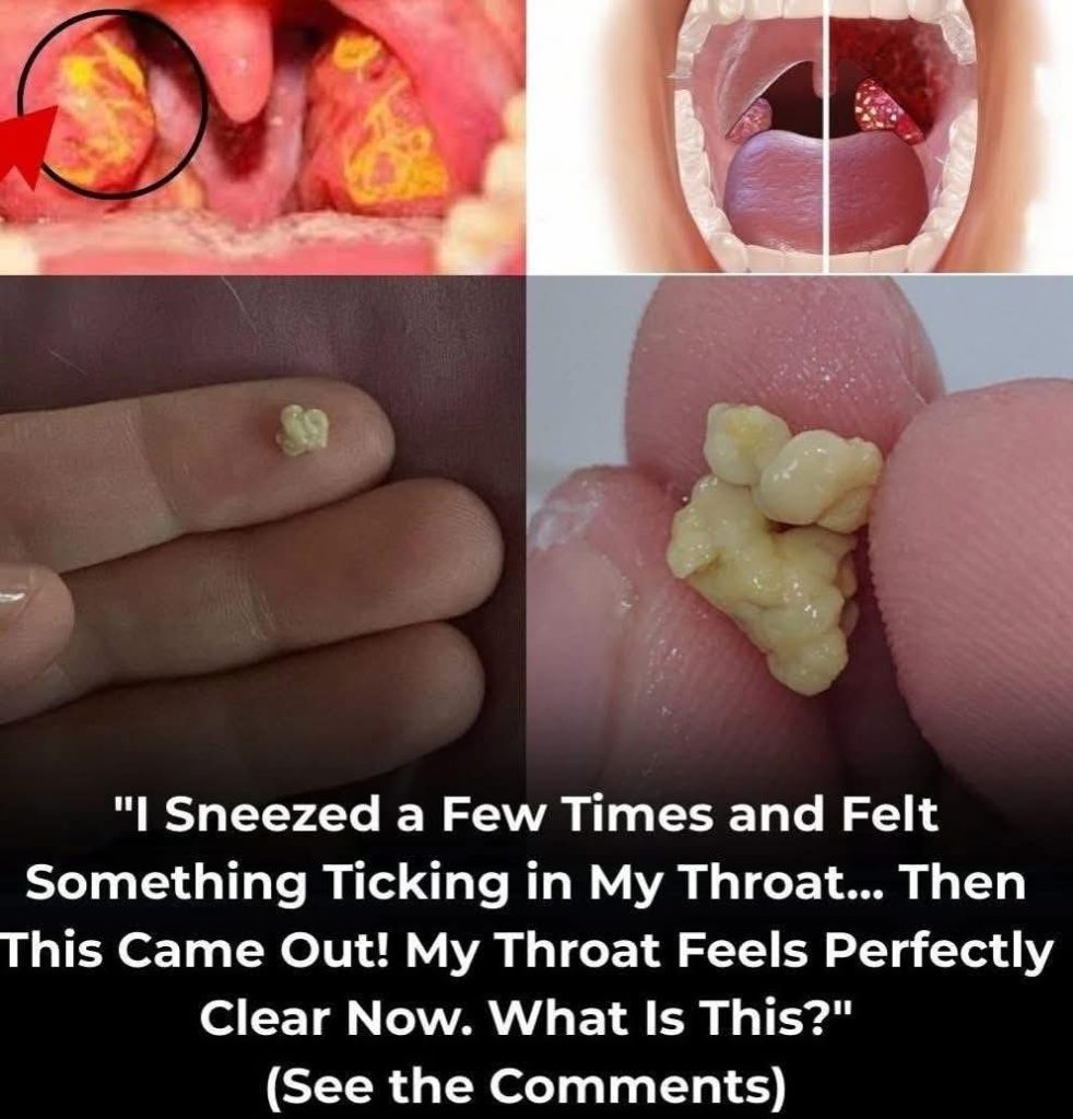 Everything You Need to Know About Tonsil Stones – Bigzazoo Luxury Garden